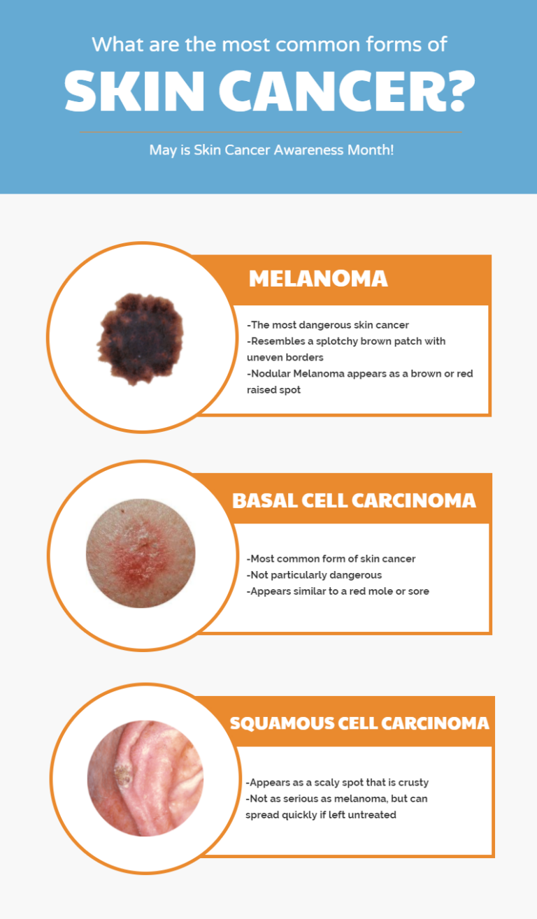 Types of Skin Cancer: Common Forms and Their Features