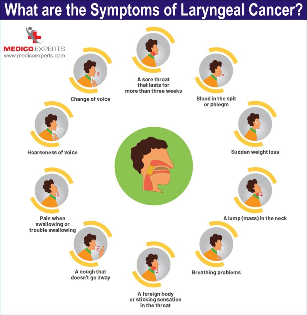 Symptoms of Laryngeal Cancer You Should Be Aware Of