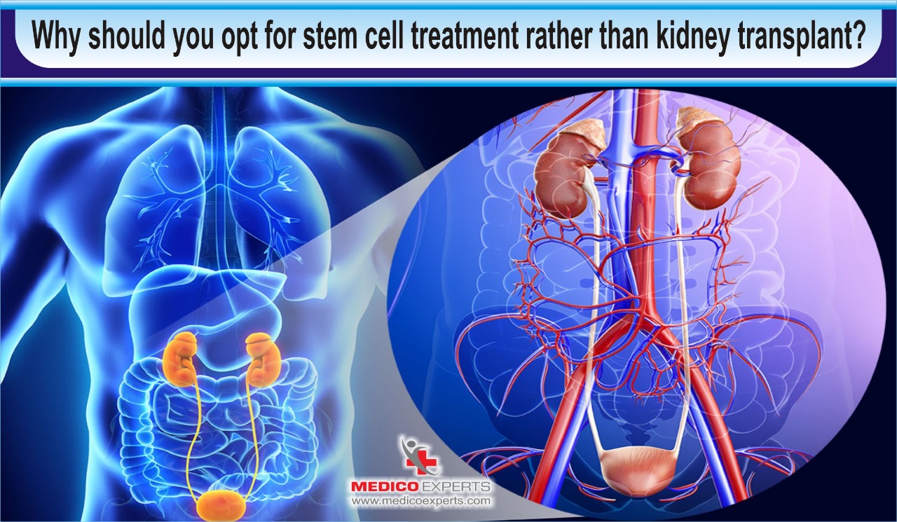 Stem cell therapy for CKD vs kidney transplant for CKD
