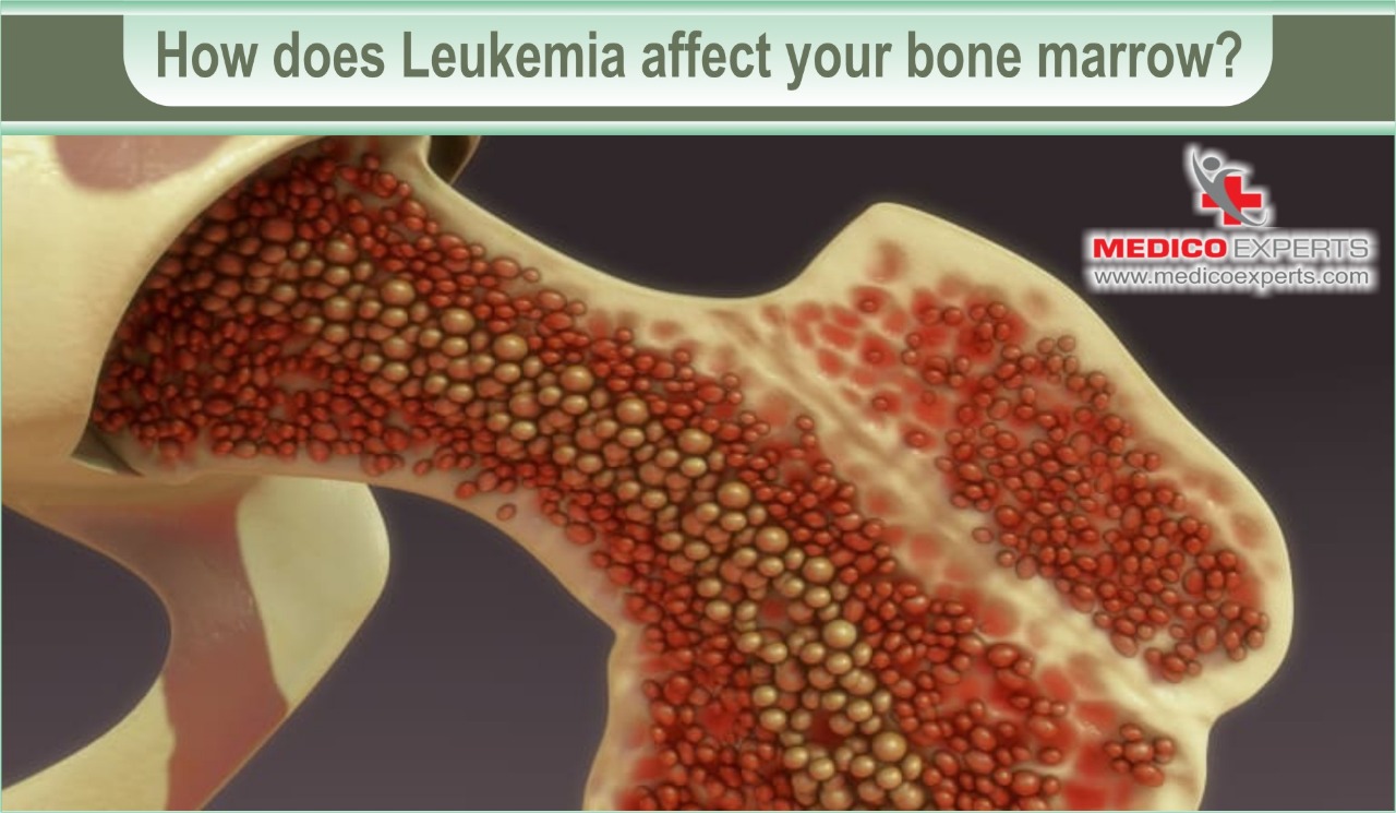 How does leukemia affect the body?