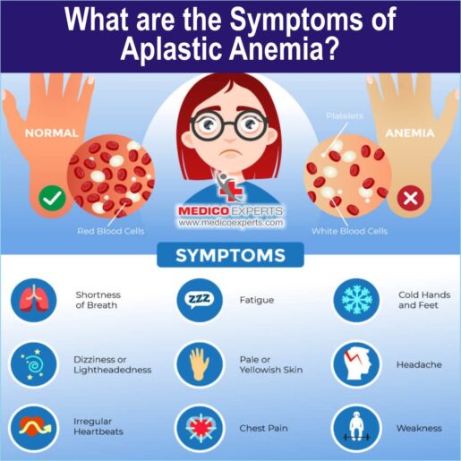 Aplastic Anemia Treatment In India With Bone Marrow Transplant
