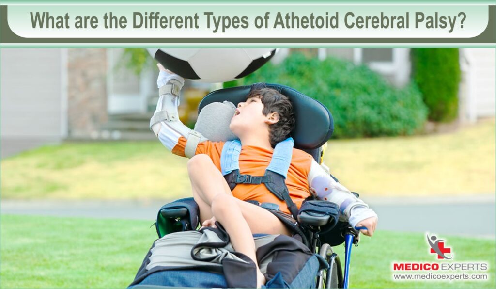 Athetoid Cerebral Palsy