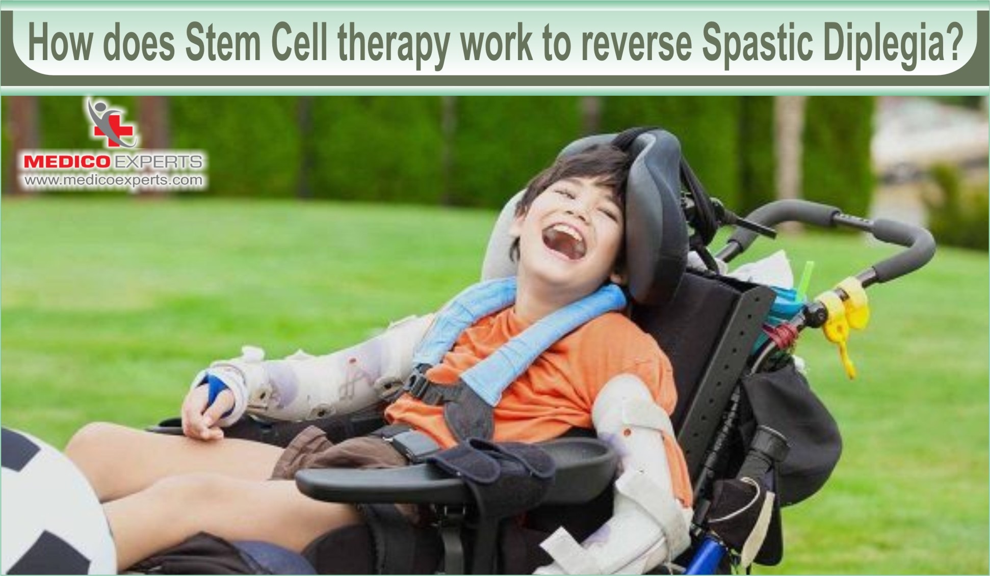 Things you must know about latest Spastic diplegia treatment