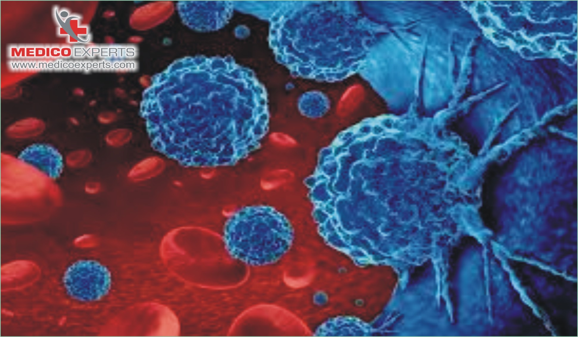 How Long Does Oral Cancer Take to Spread? Signs & Treatment