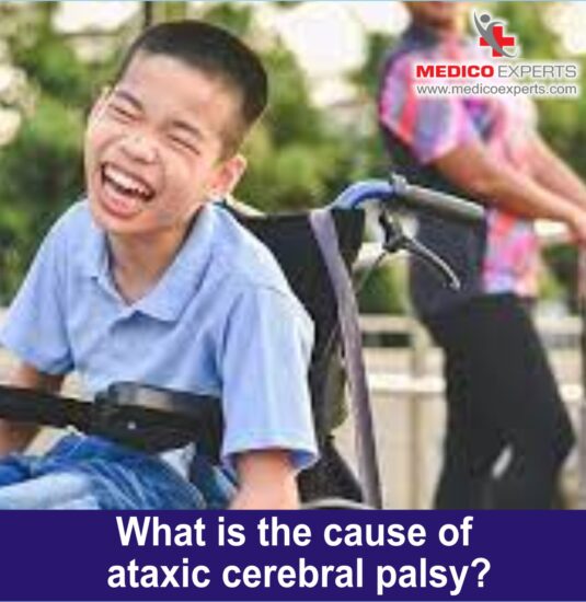 Ataxic cerebral palsy treatment with stem cell therapy