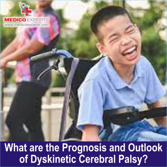 Proactive Treatment for Dyskinetic Cerebral Palsy