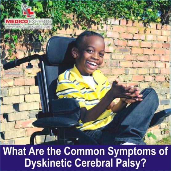 Proactive Treatment for Dyskinetic Cerebral Palsy