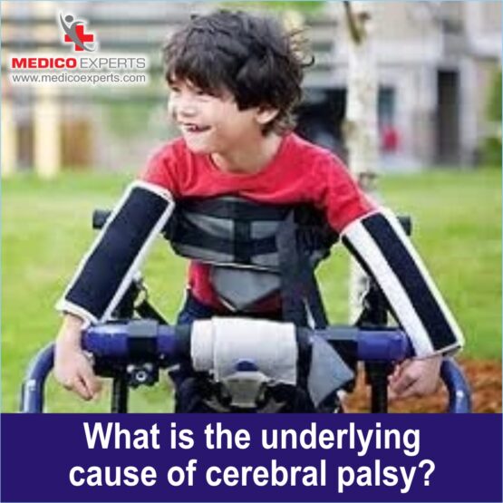Proactive Treatment for Dyskinetic Cerebral Palsy