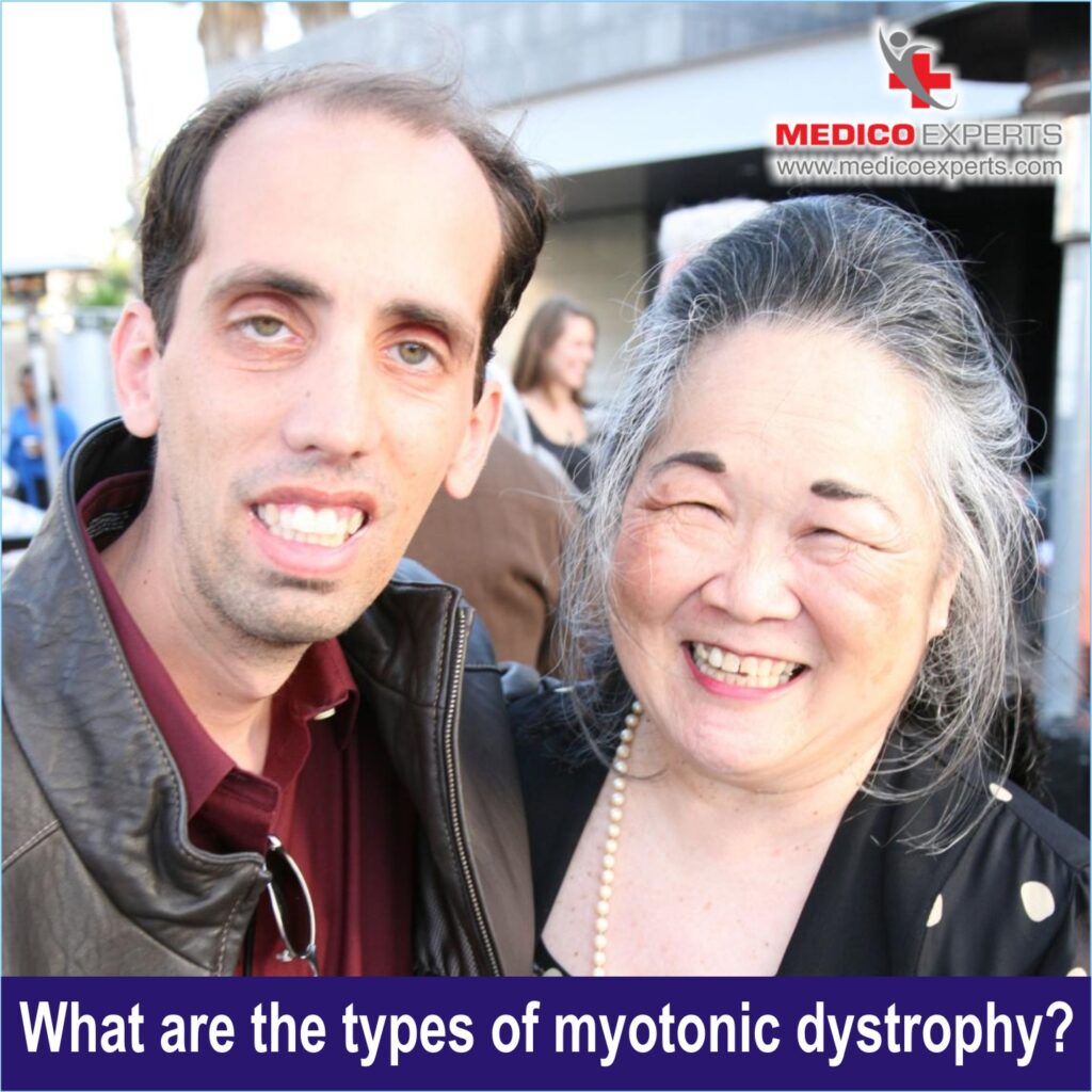 A Reliable Cure Option for Myotonic Dystrophy Treatment