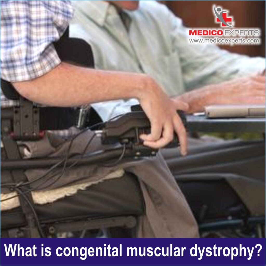 Congenital Muscular Dystrophy: Causes & Treatment Options