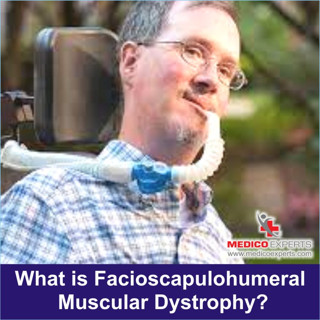 Facioscapulohumeral Muscular Dystrophy: Stem Cell Treatment