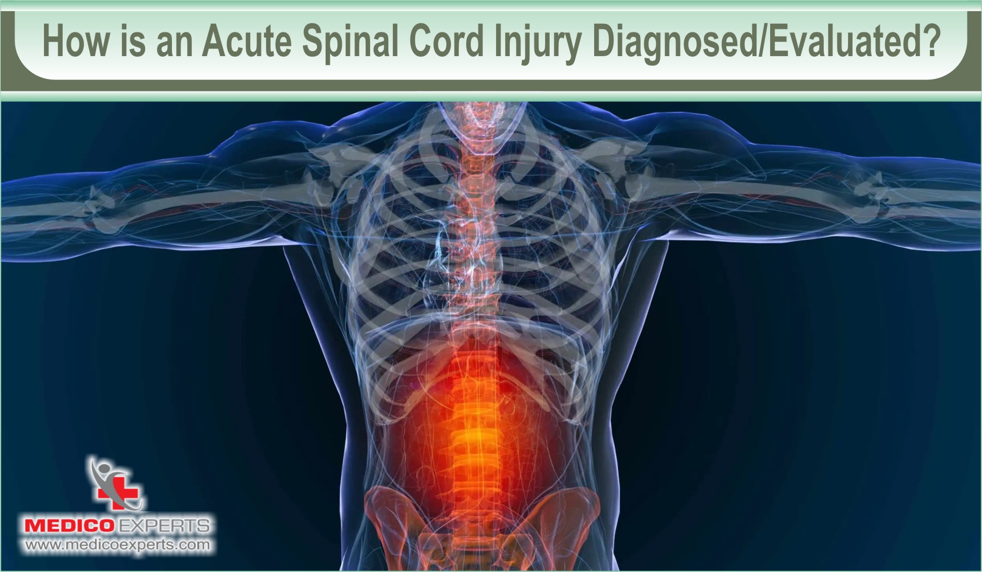 Acute Spinal Cord Injury Treatment: A Bridge to Recovery