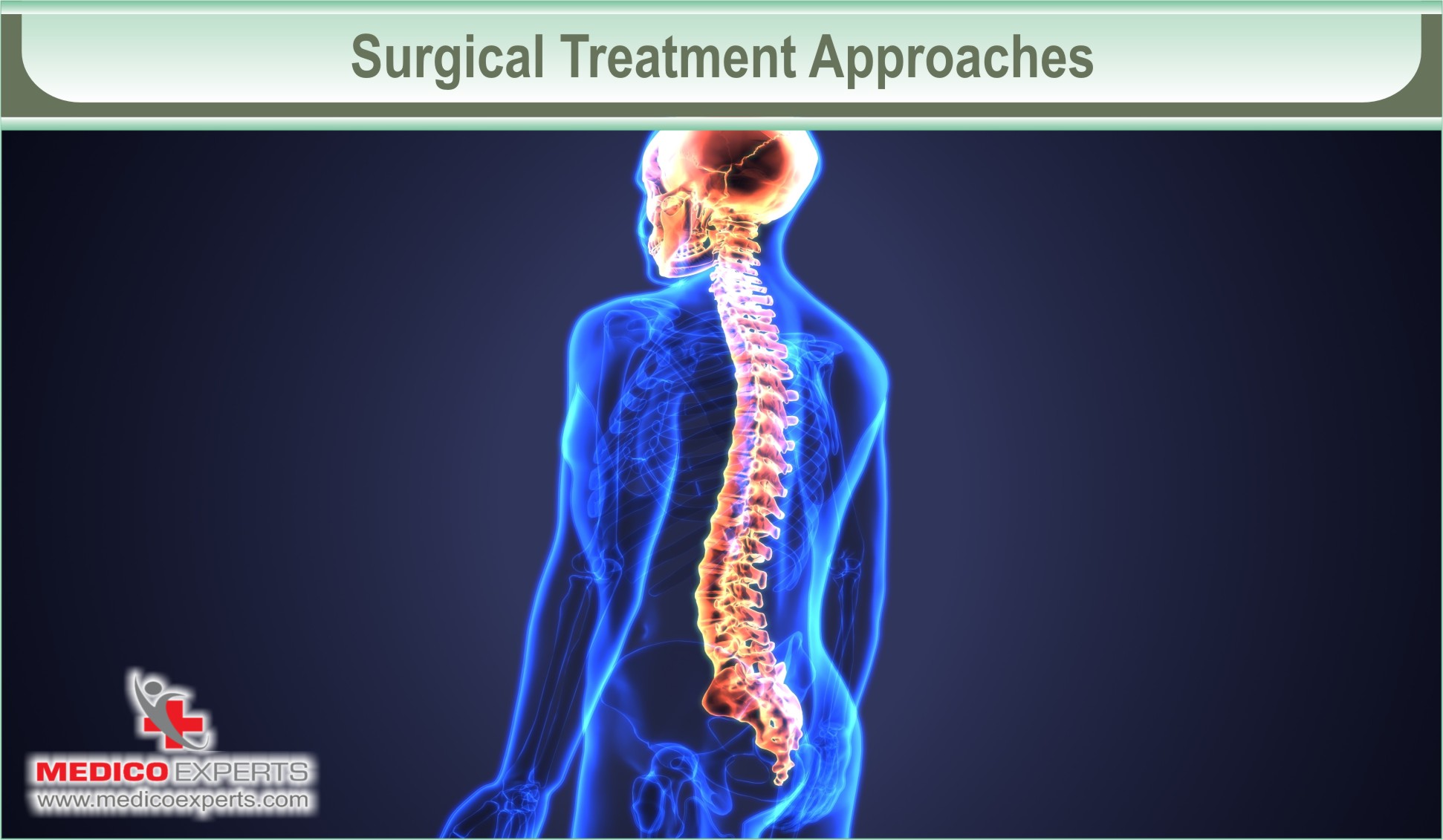 Acute Spinal Cord Injury Treatment: A Bridge to Recovery