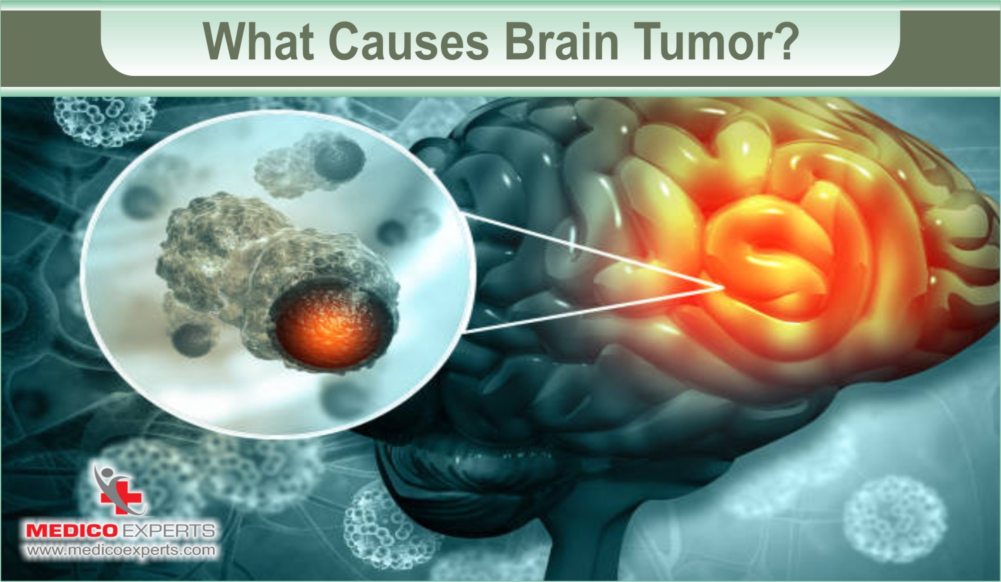 Brain Tumor Symptoms: Learn to save lives
