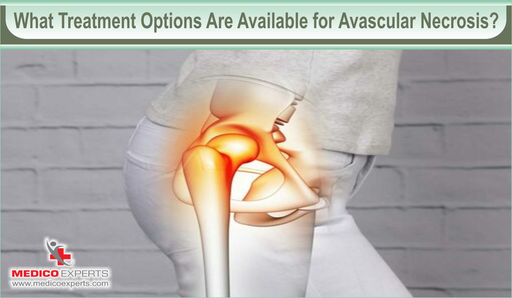 Answered: Can Avascular Necrosis be Reversed?