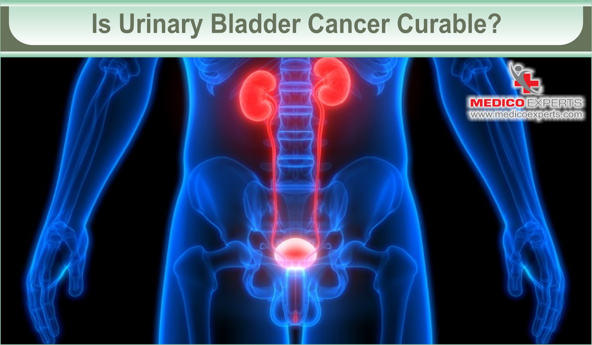 Answered: Is urinary bladder cancer curable?