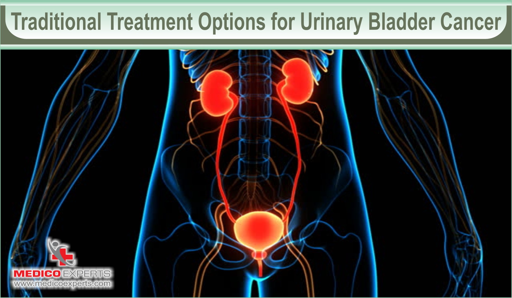 Answered: Is urinary bladder cancer curable?