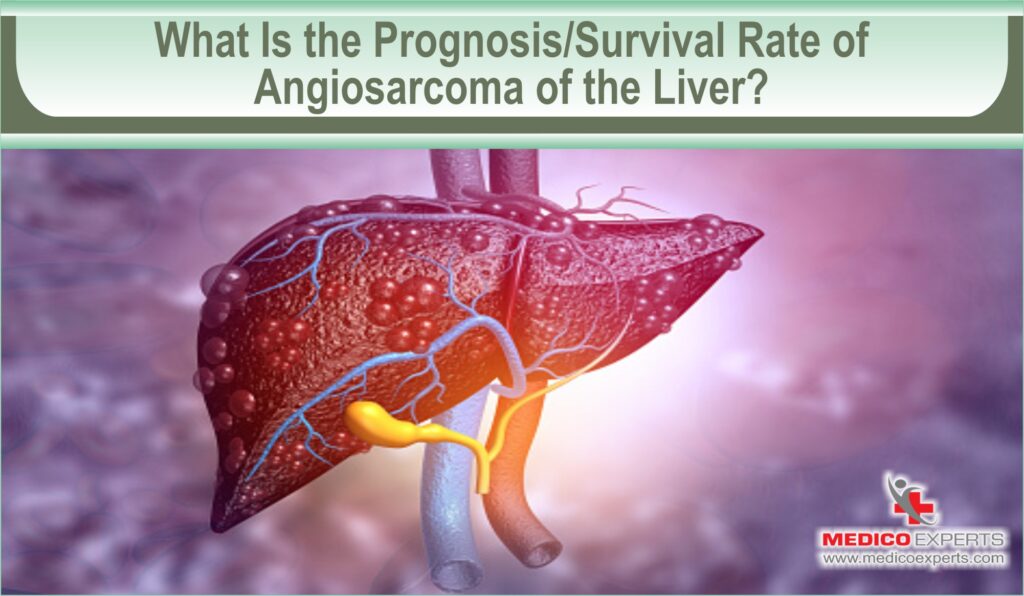 Angiosarcoma Liver