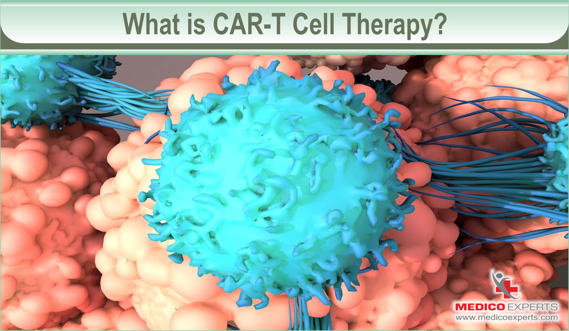 Hope For Patients With Cancer Car T Cell Therapy In India