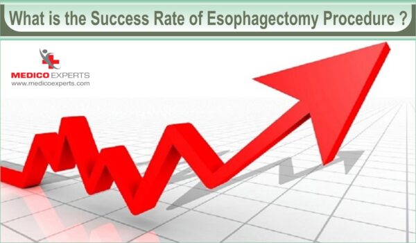 Esophagectomy Surgery: Procedure, Risk, & Benefits