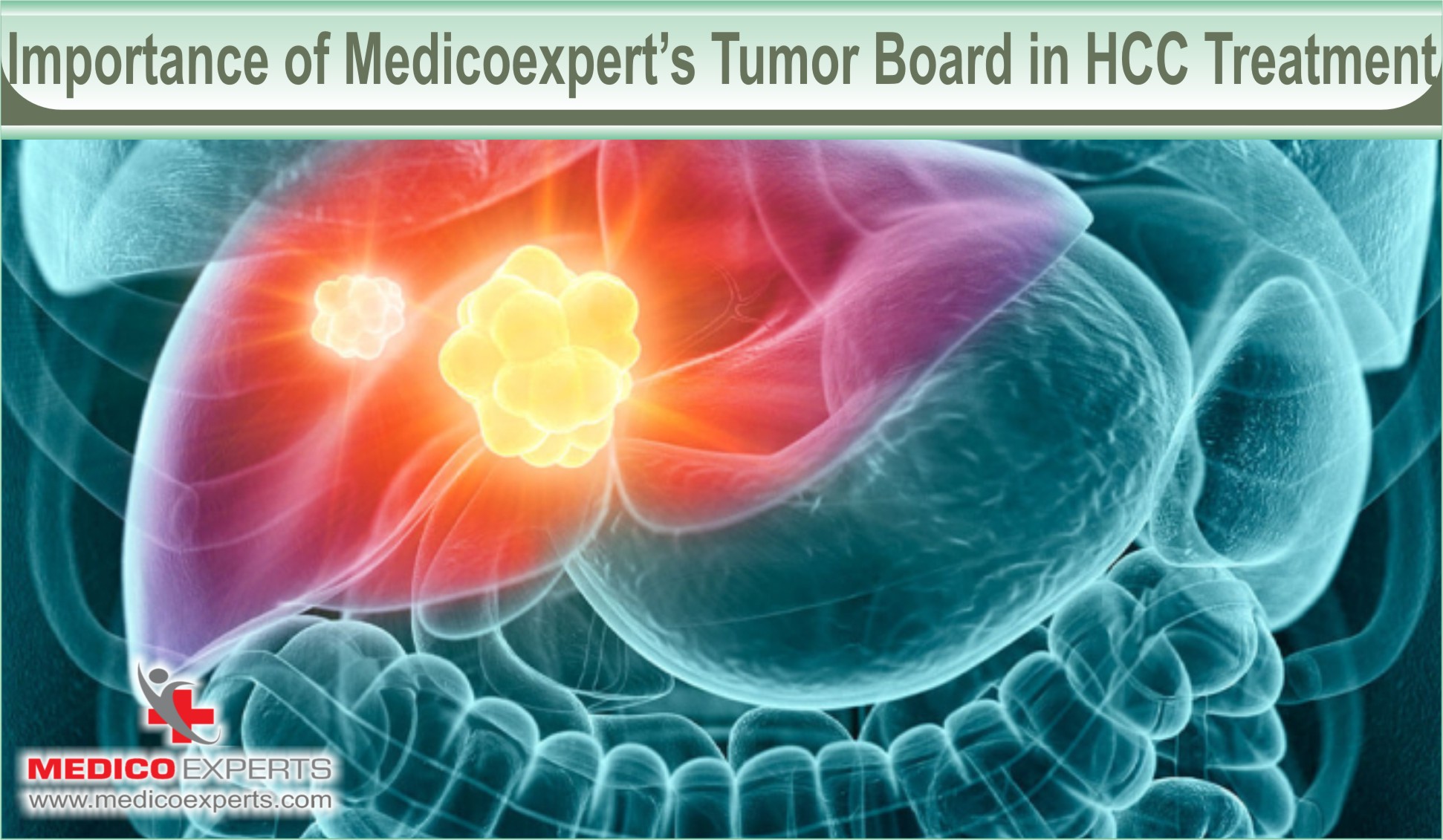 Hepatocellular carcinoma treatment to cure your liver