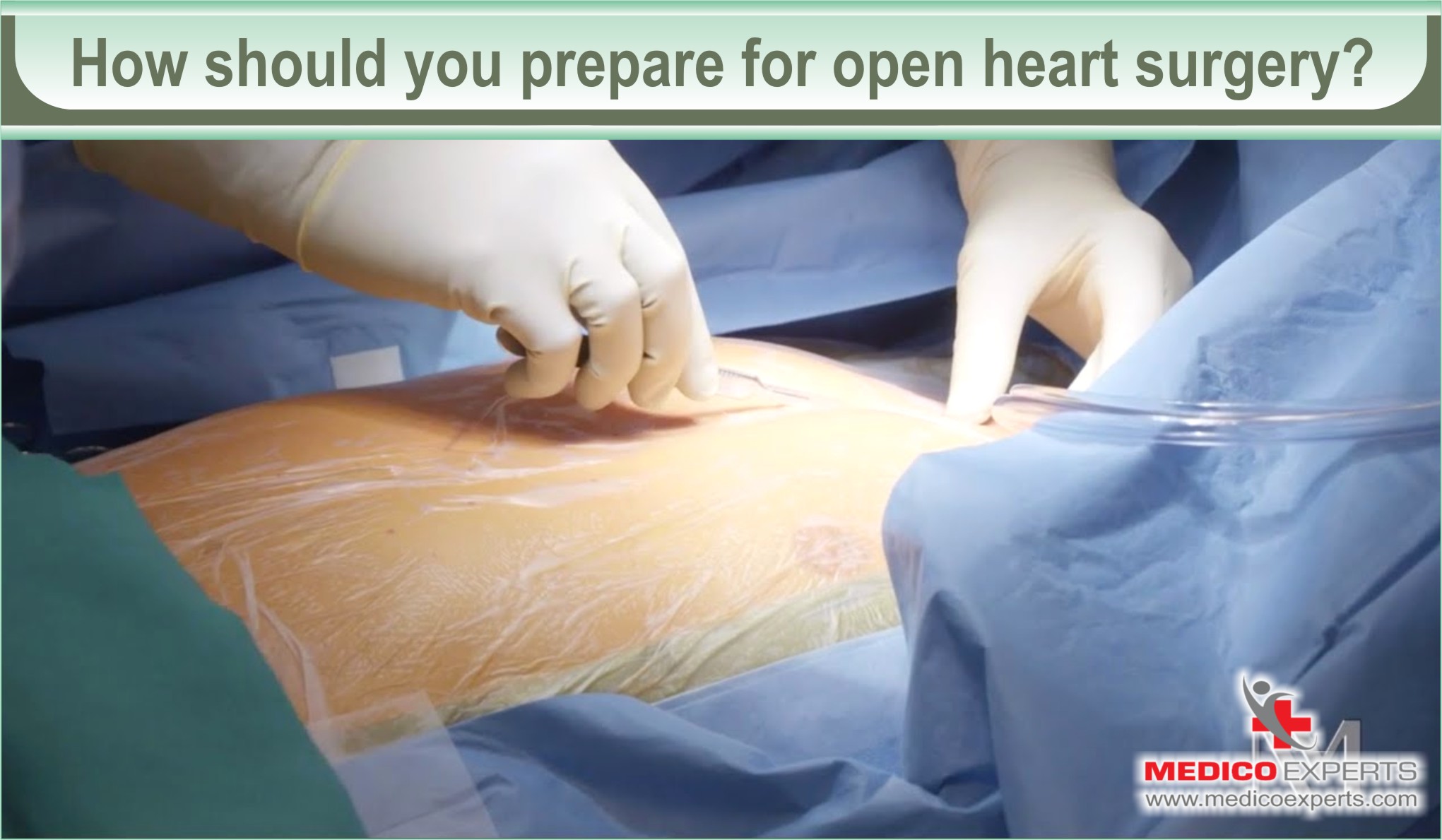 Open Heart Surgery in India: Detailed Guide