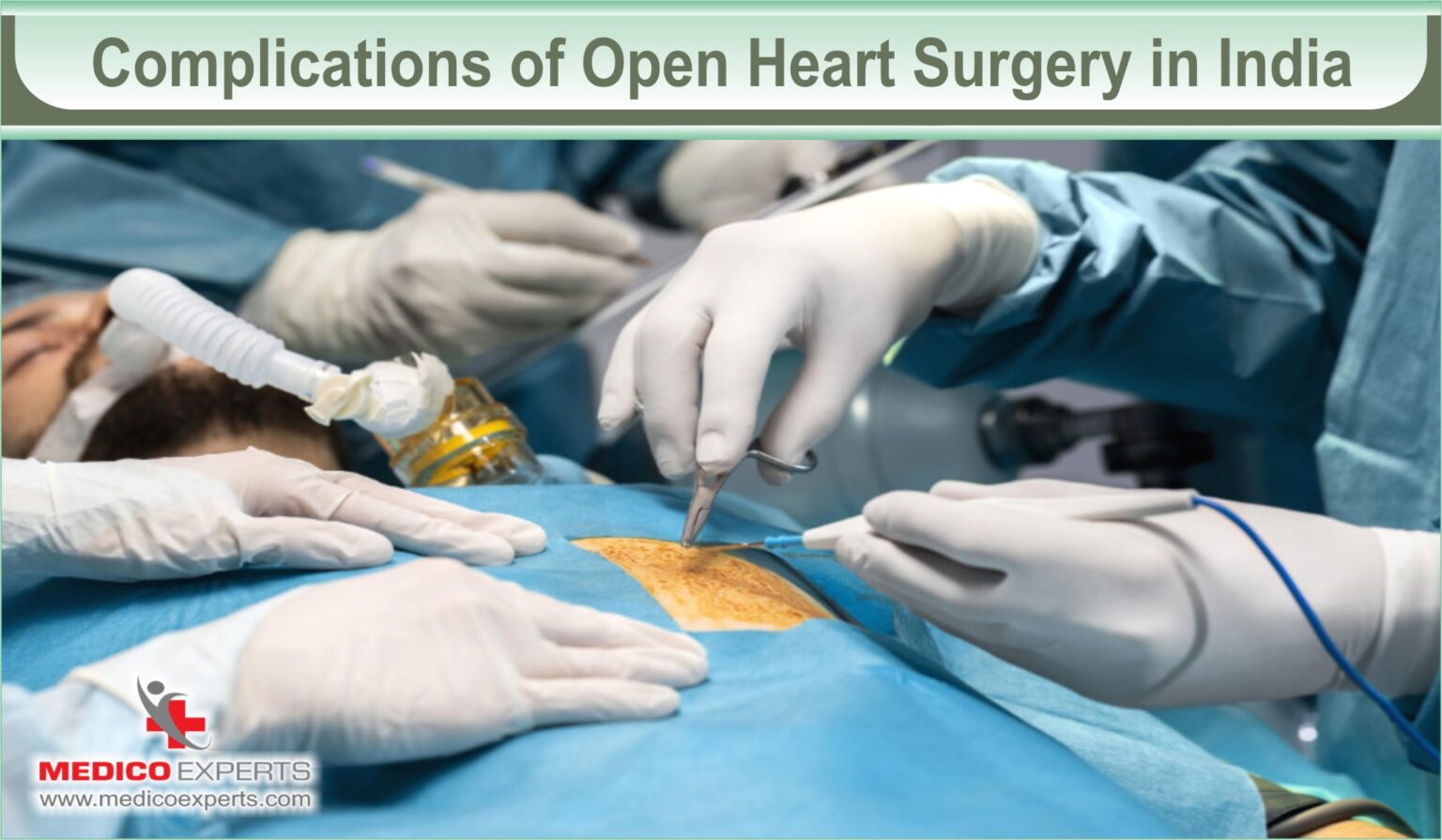 Open Heart Surgery in India: Detailed Guide