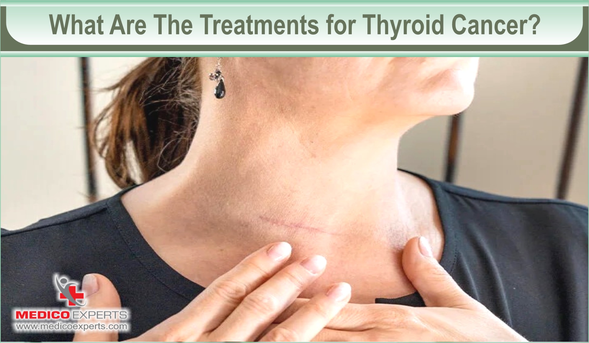 How Can Thyroid Cancer Be Cured? Things You Should Know