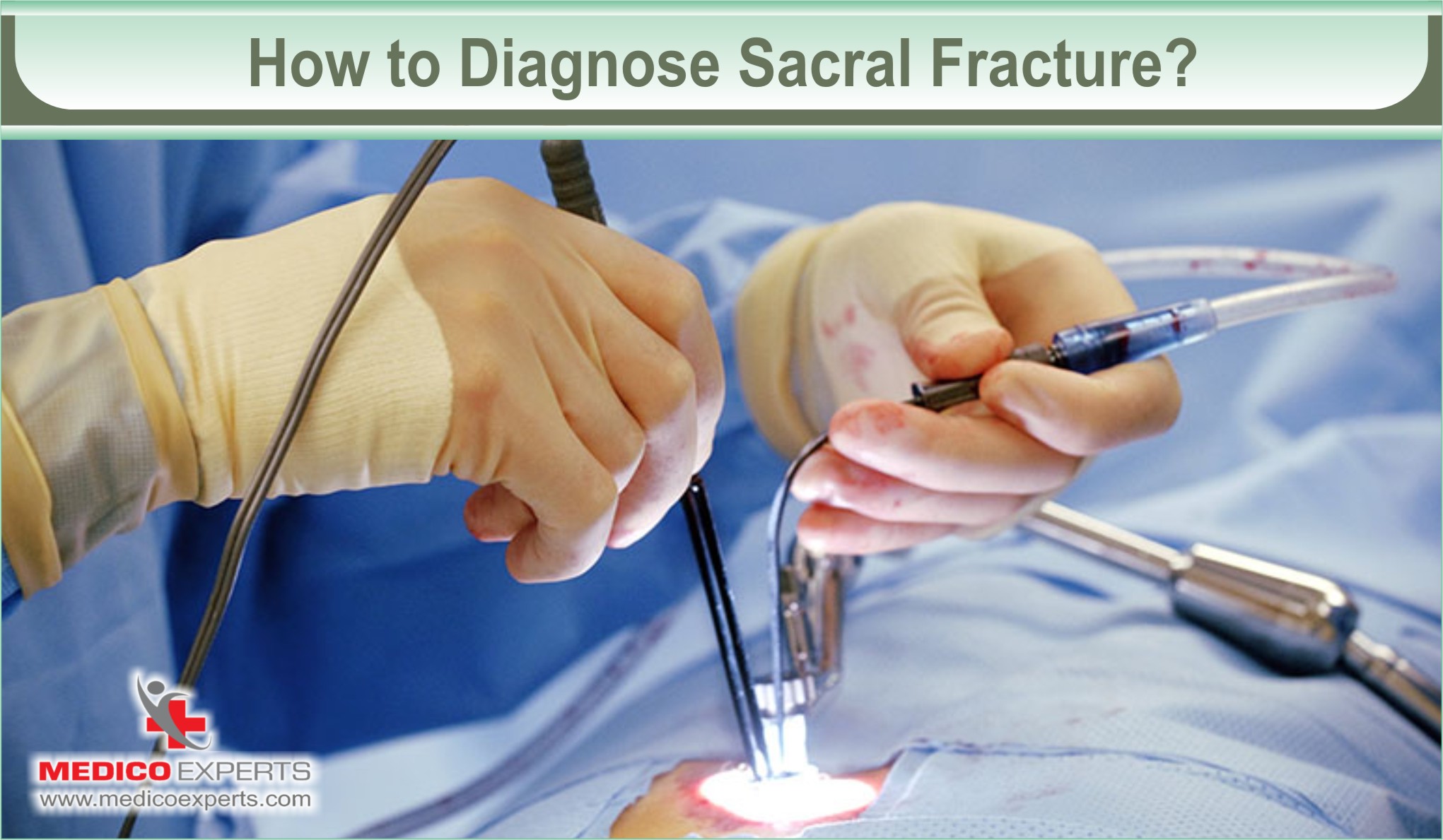 Sacral Fracture Treatment: Regain Mobility & Comfort Fast