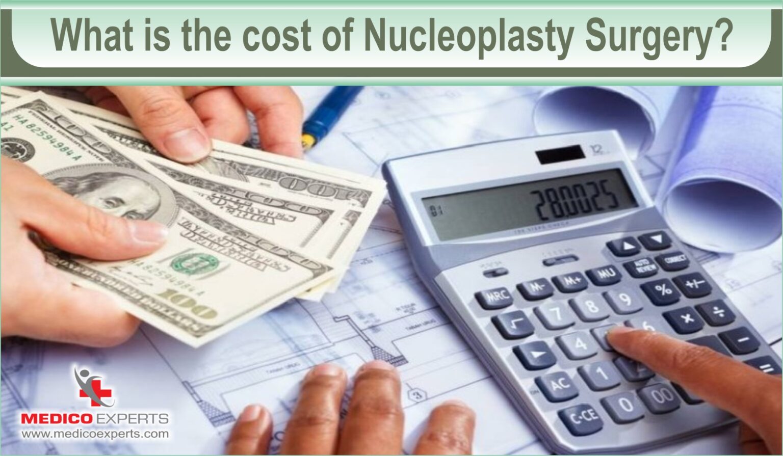 Understanding Nucleoplasty: Key Facts and Benefits