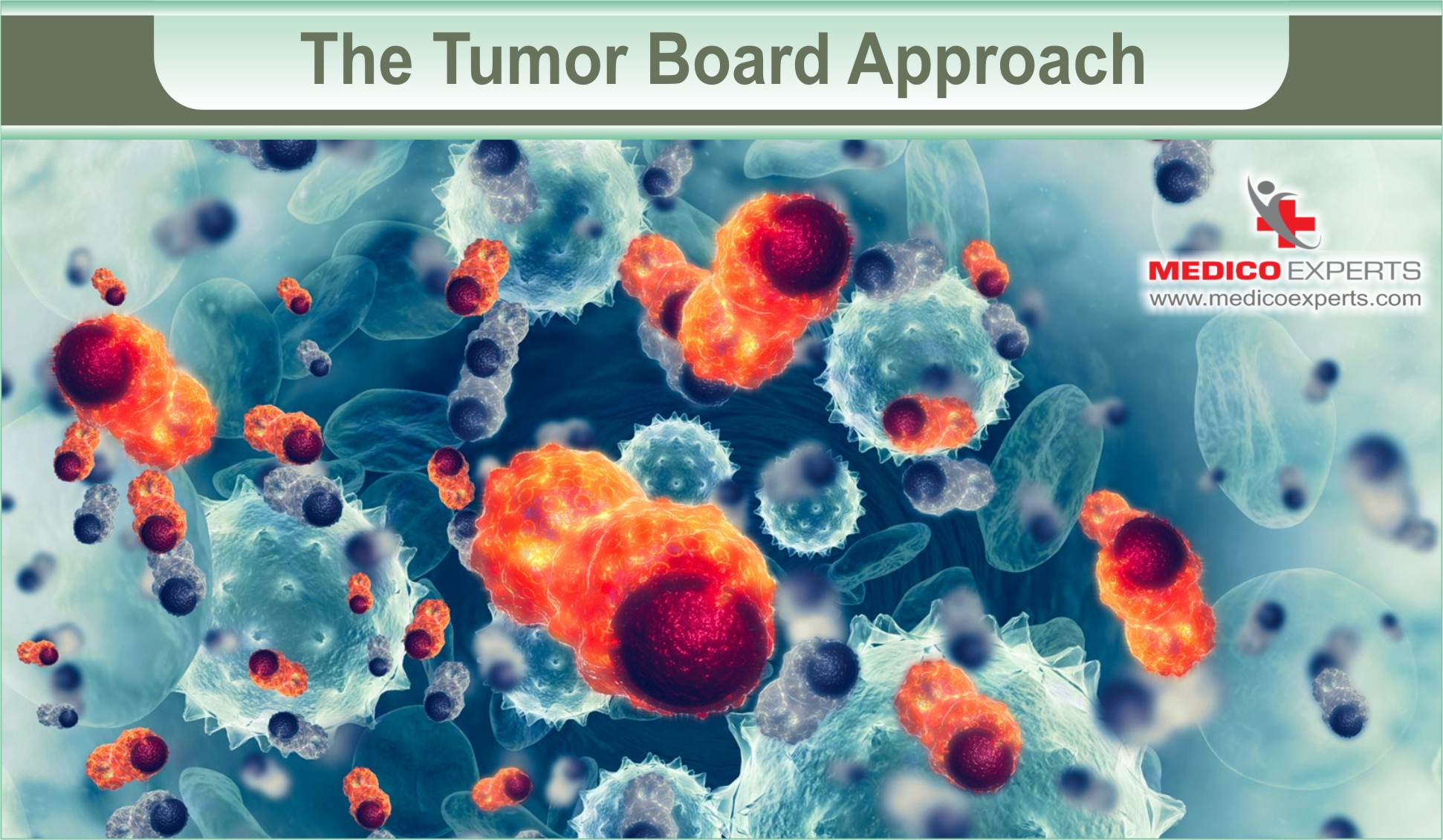 Tumor Board Approach: Direction For Oral Cancer Treatment
