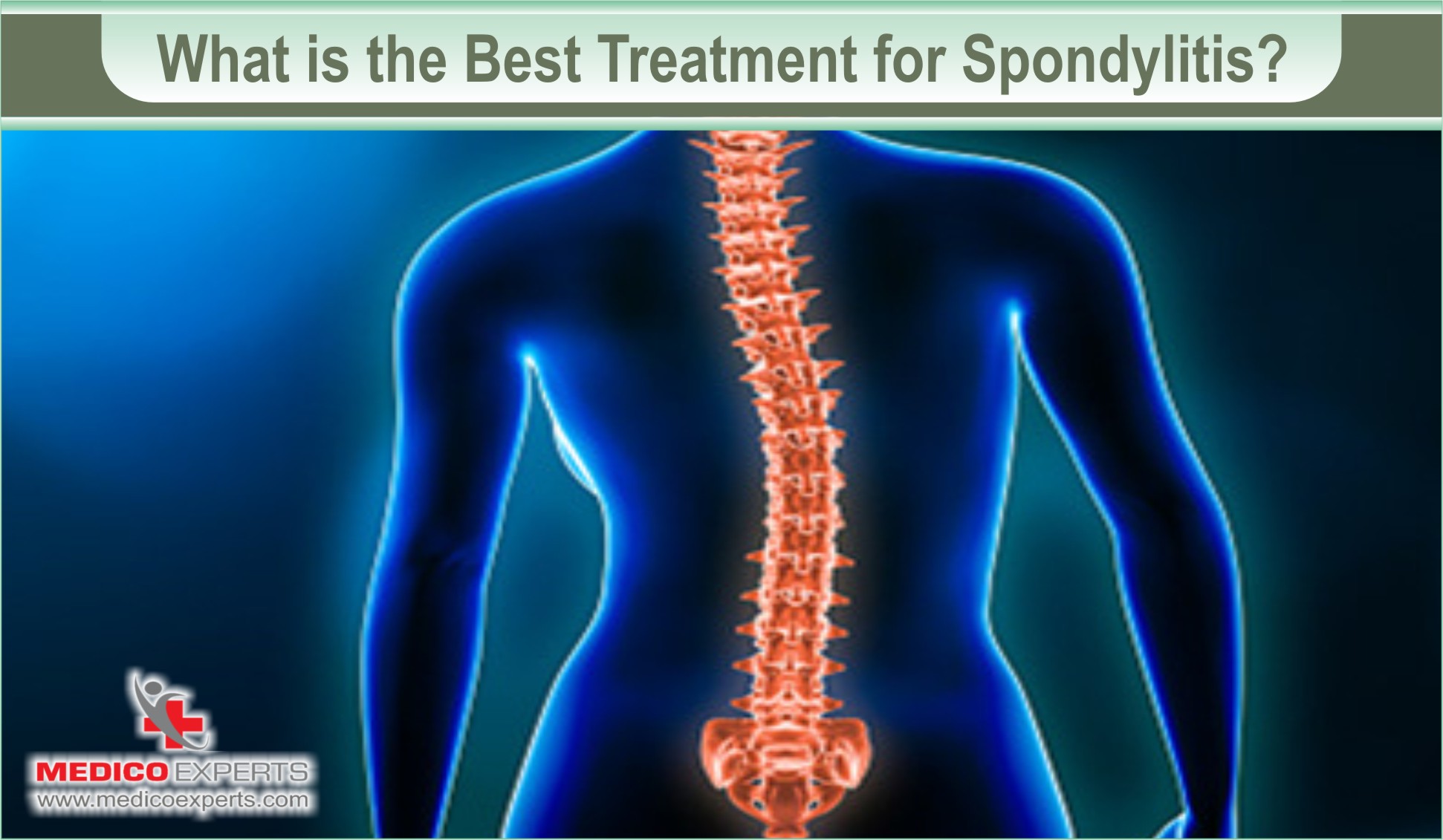 Live Pain-free: Best Treatment for Spondylitis