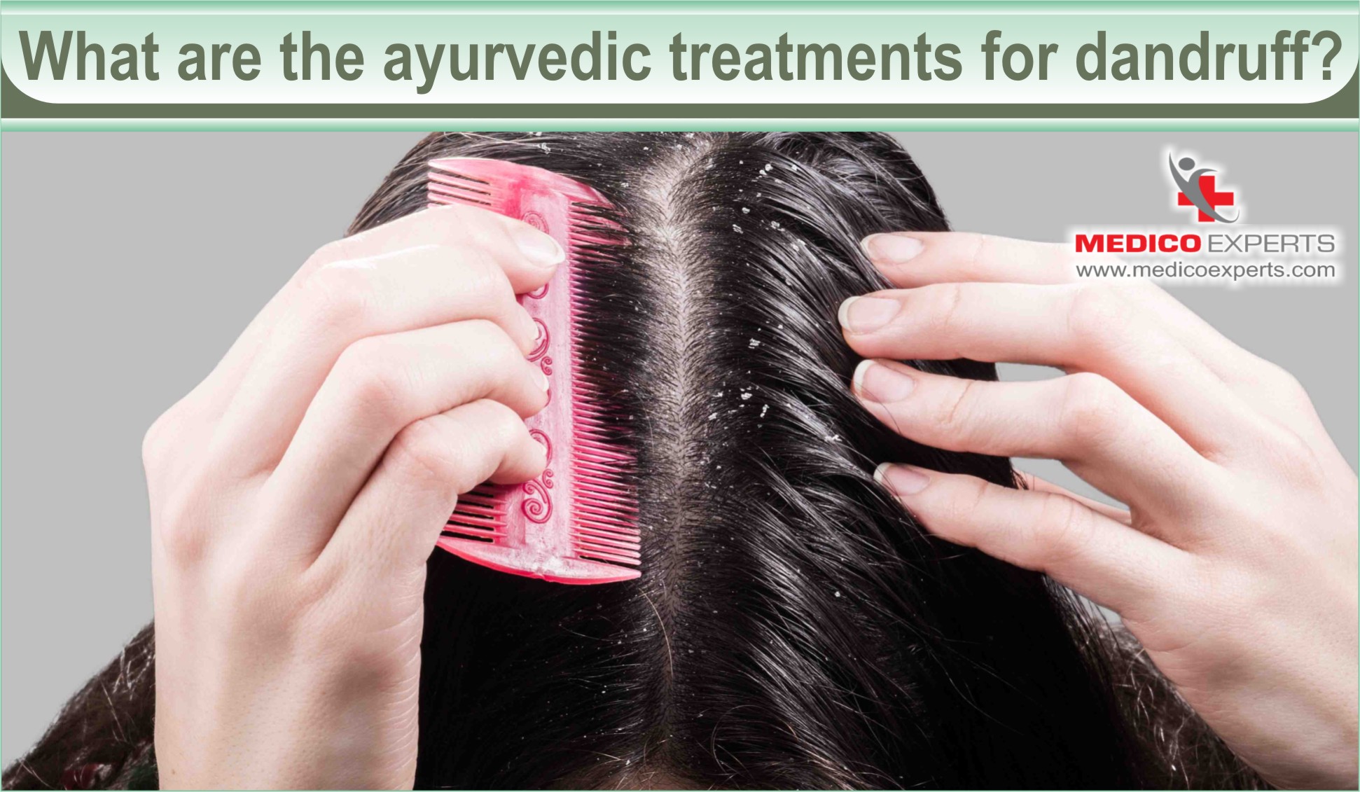 Naturally Clear: Ayurvedic Treatment for Dandruff