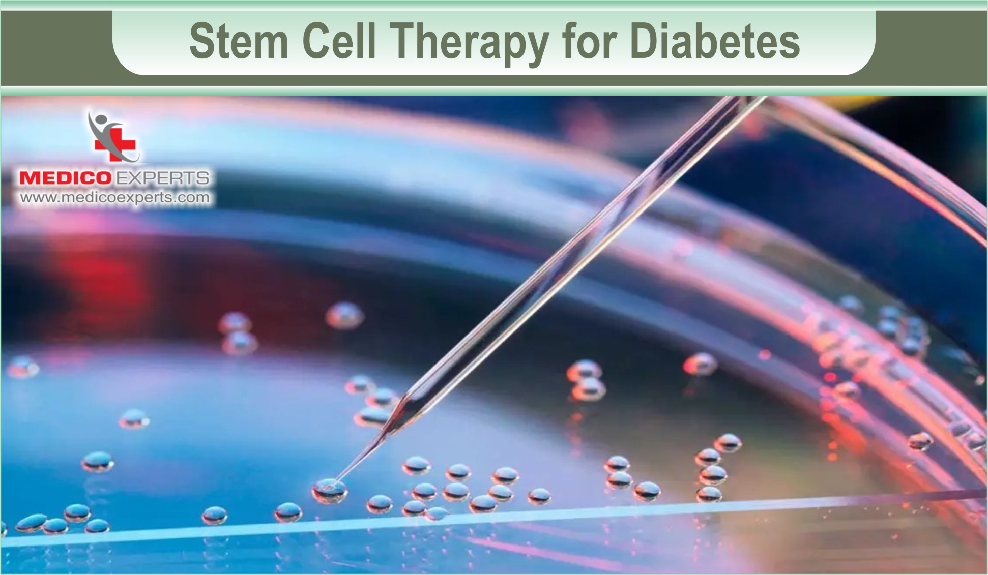 How Does Stem Cell Therapy Work? Understand the Process