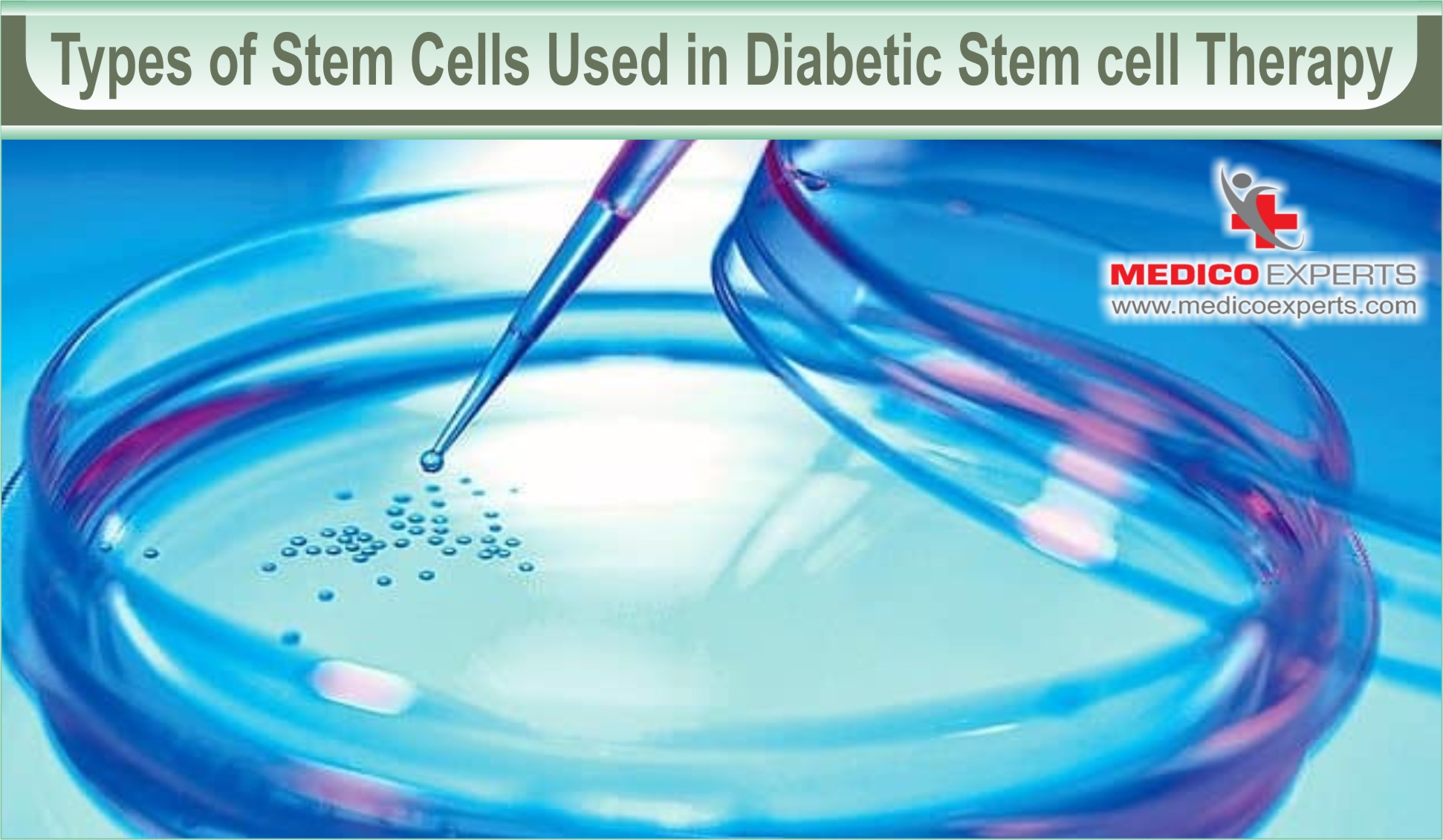 How Does Stem Cell Therapy Work? Understand the Process