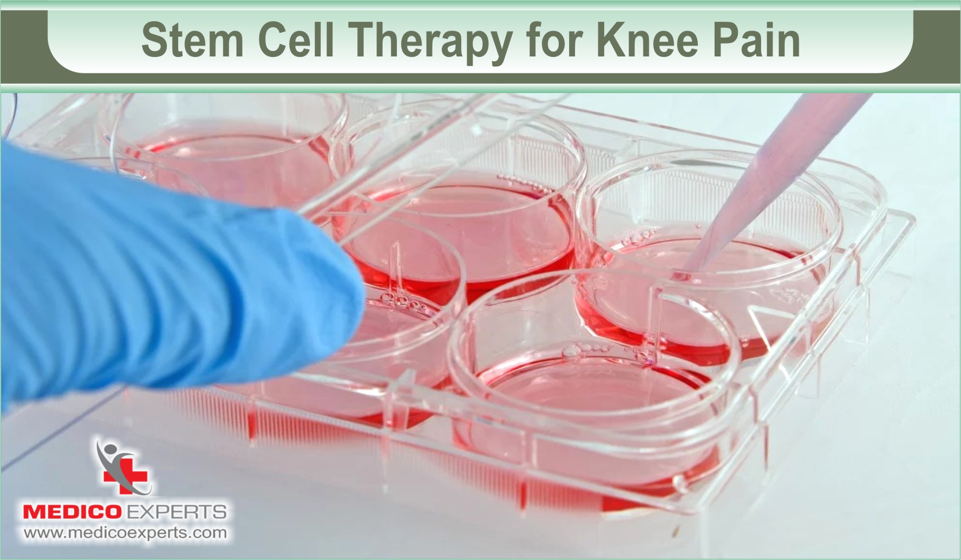 How Does Stem Cell Therapy Work? Understand the Process
