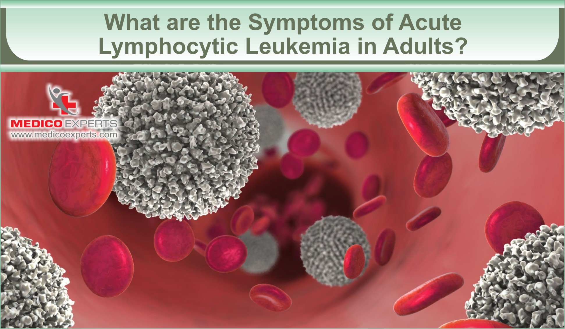 Acute Leukemia in Adults - A Closer Look