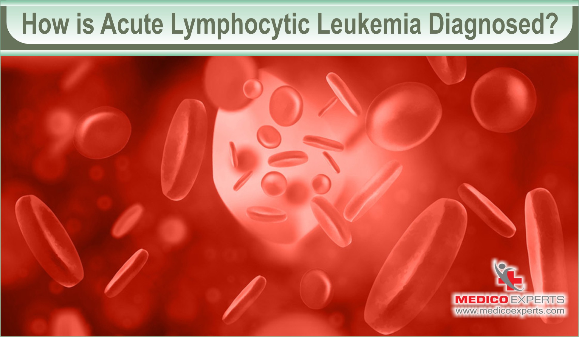 Acute Leukemia in Adults - A Closer Look