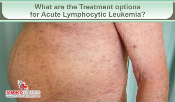 Acute Leukemia in Adults - A Closer Look