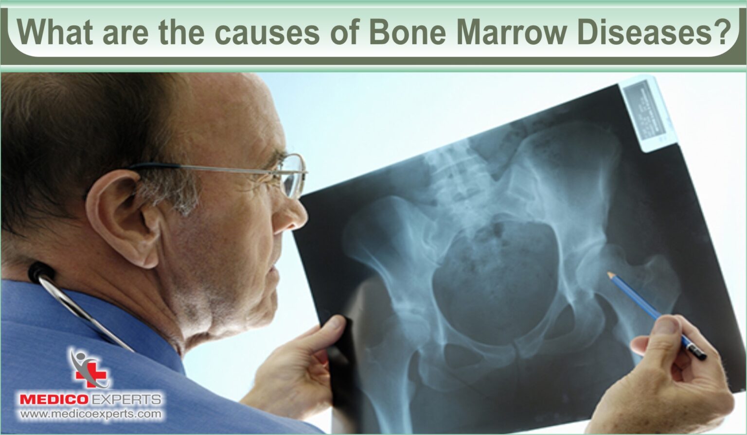 Your Ultimate Guide to Bone Marrow Diseases and Recovery