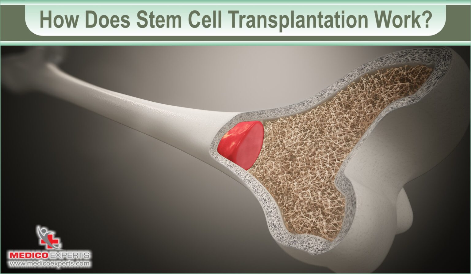 Your Ultimate Guide to Bone Marrow Diseases and Recovery