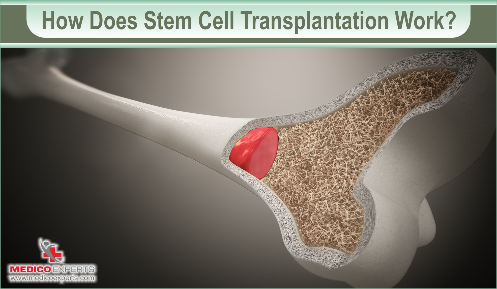 Your Ultimate Guide to Bone Marrow Diseases and Recovery