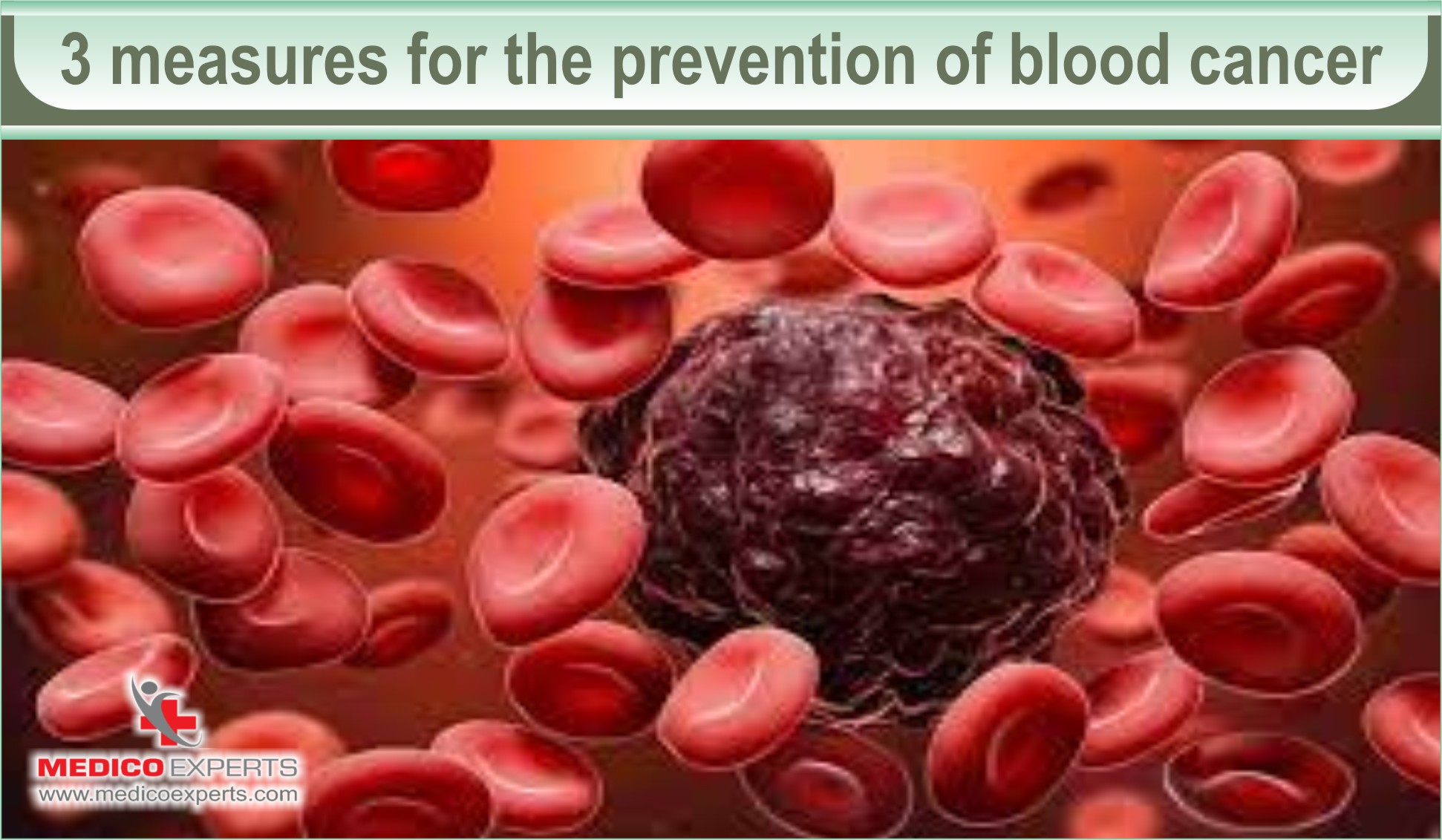 Prevention of Blood Cancer: 3 proactive measures to stay healthy