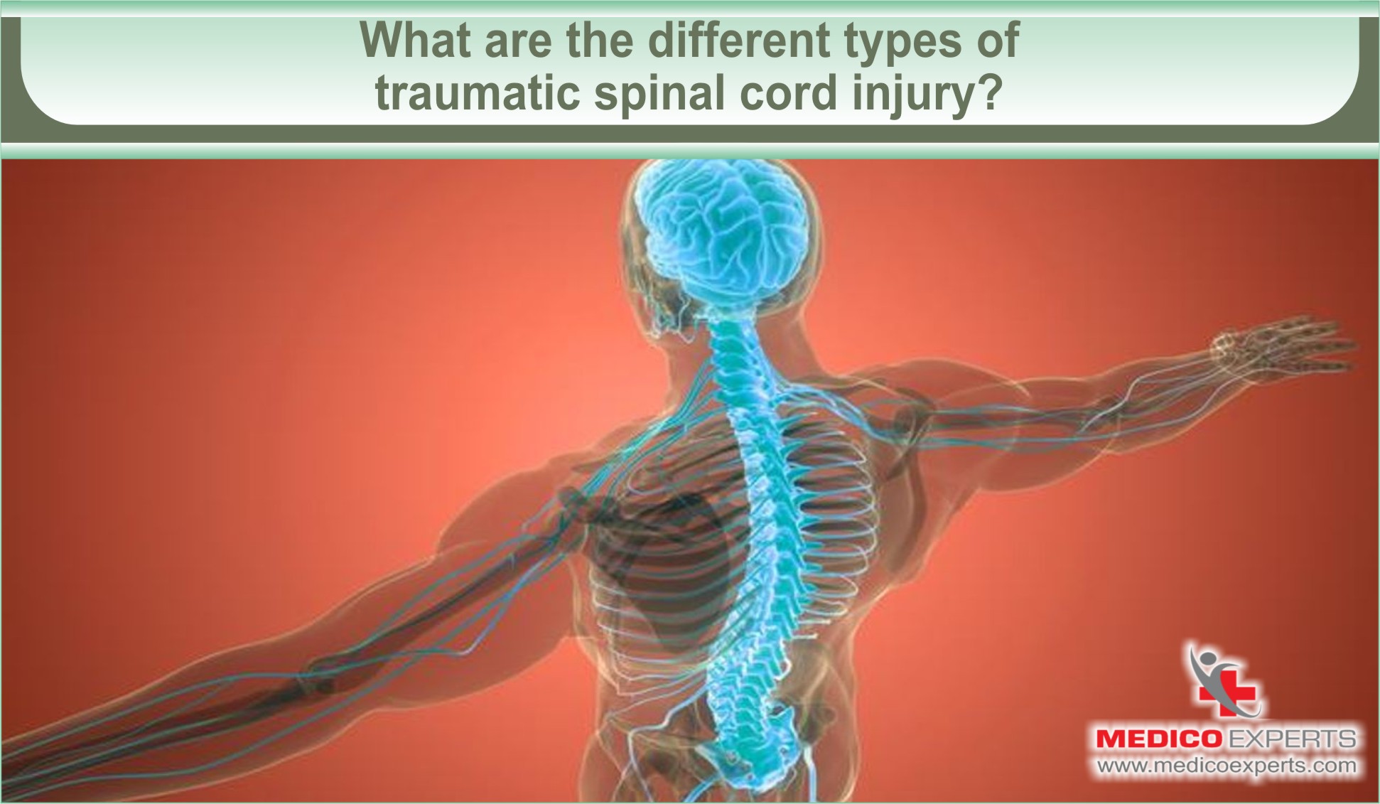 Traumatic Spinal Cord Injury Types: An Overview