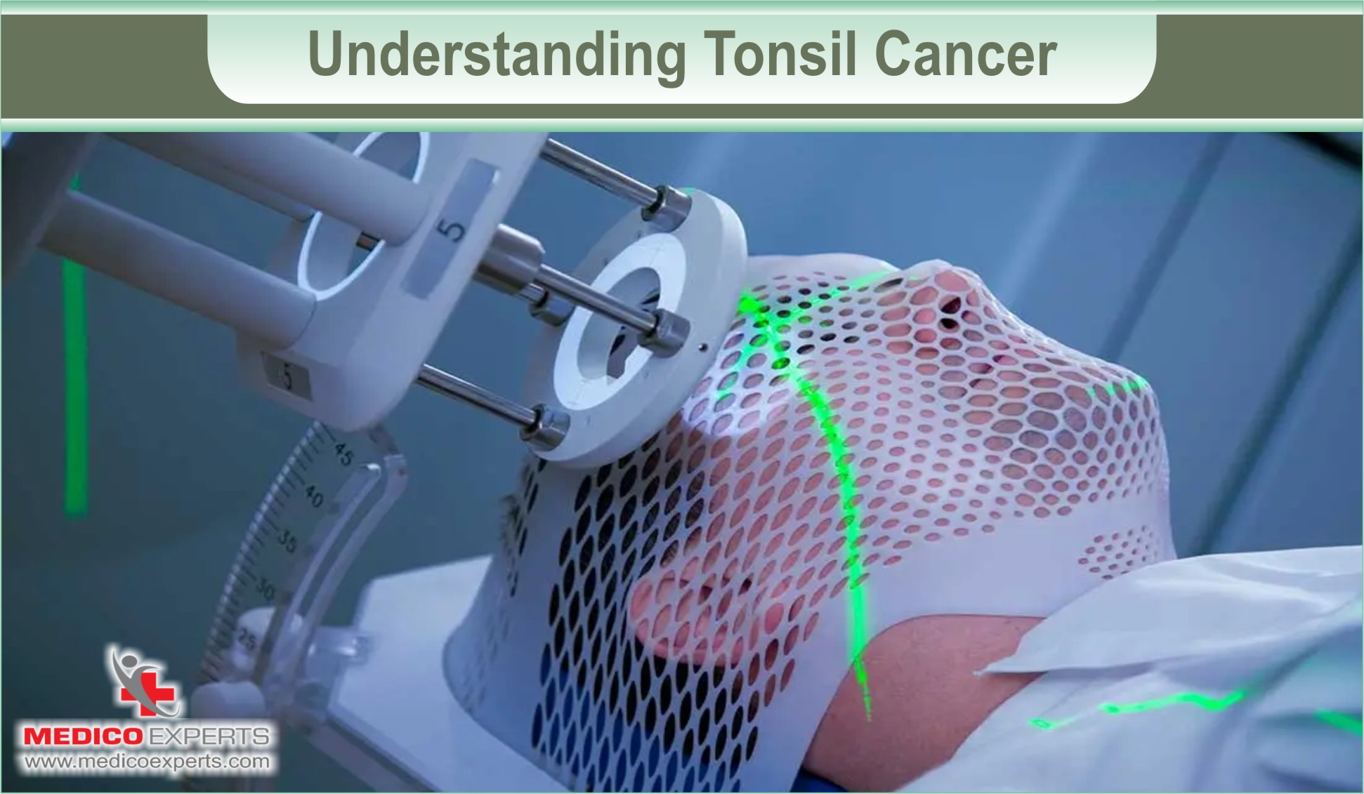 What are the first signs of Tonsil Cancer? Recognising early warnings