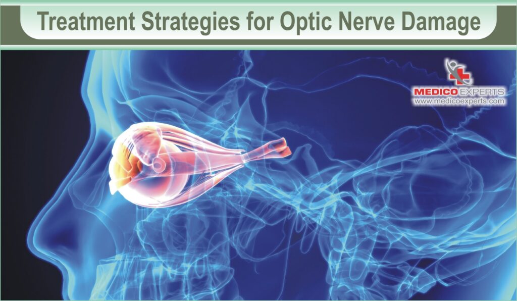 Optic Nerve Regeneration: A New Frontier in Vision Restoration