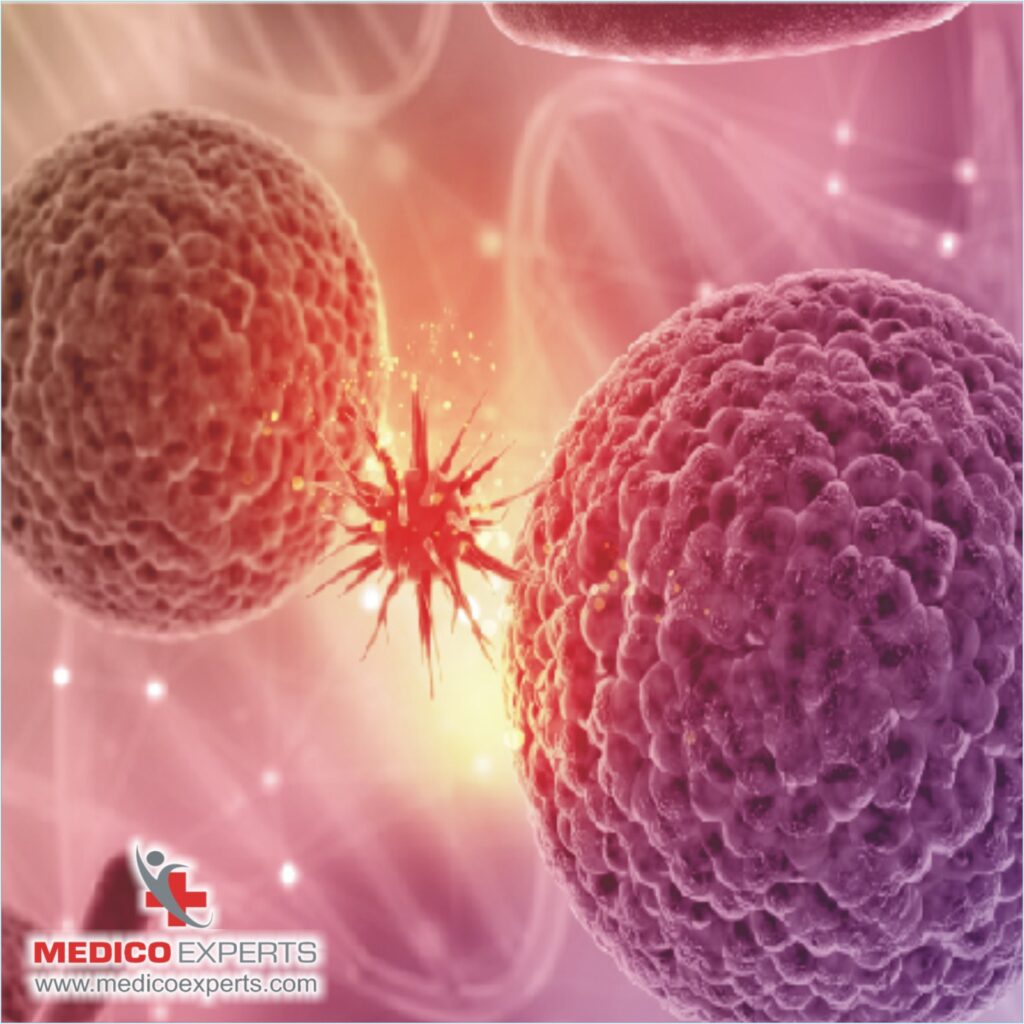 Detailed Guide on Non-hodgkin's Lymphoma Treatment Options