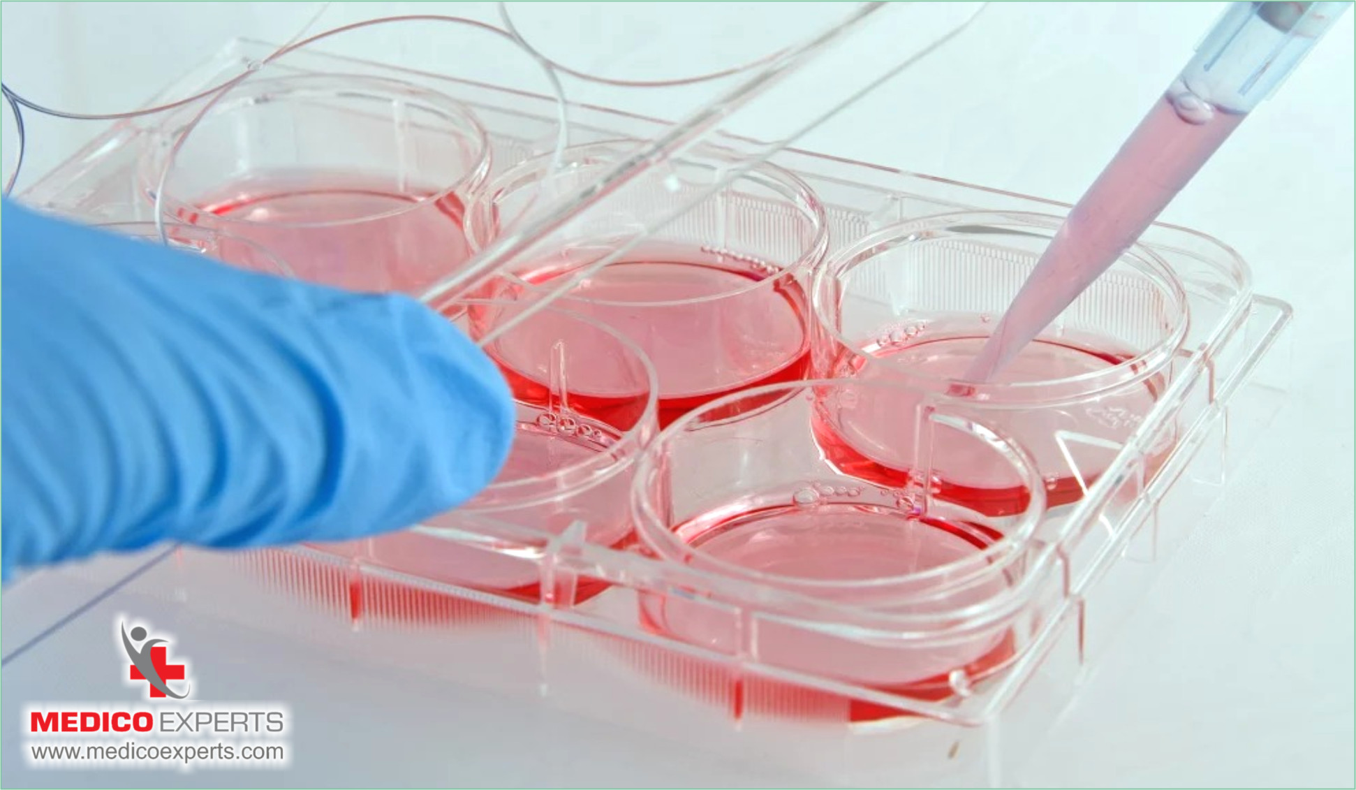 Stem Cell Therapy Process for Vision: A Complete Guide