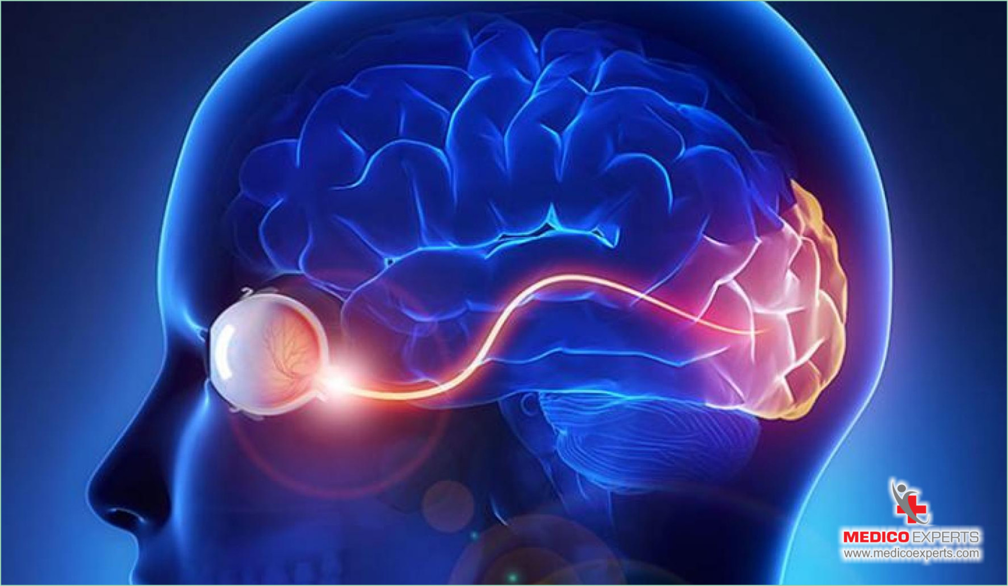 Symptoms of Optic Nerve Damage: Signs You Shouldn’t Ignore