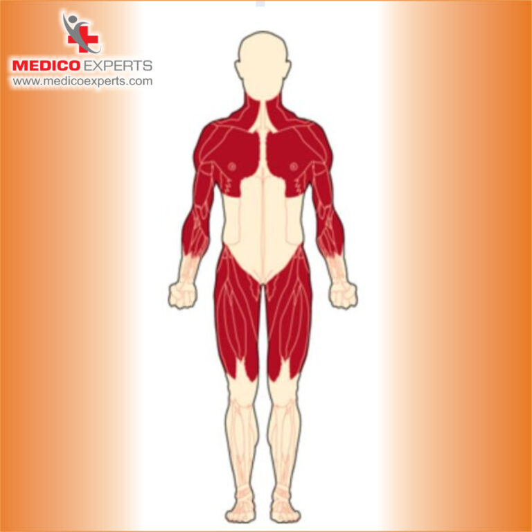 Muscular Dystrophy Symptoms: Causes & Treatment Options